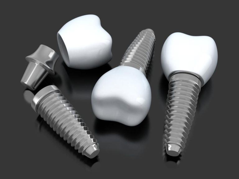For Clinicians - Camlog Implants